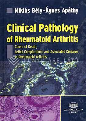 Clinical Pathology of Rheumatoid Arthritis-KELLO Online könyvesbolt